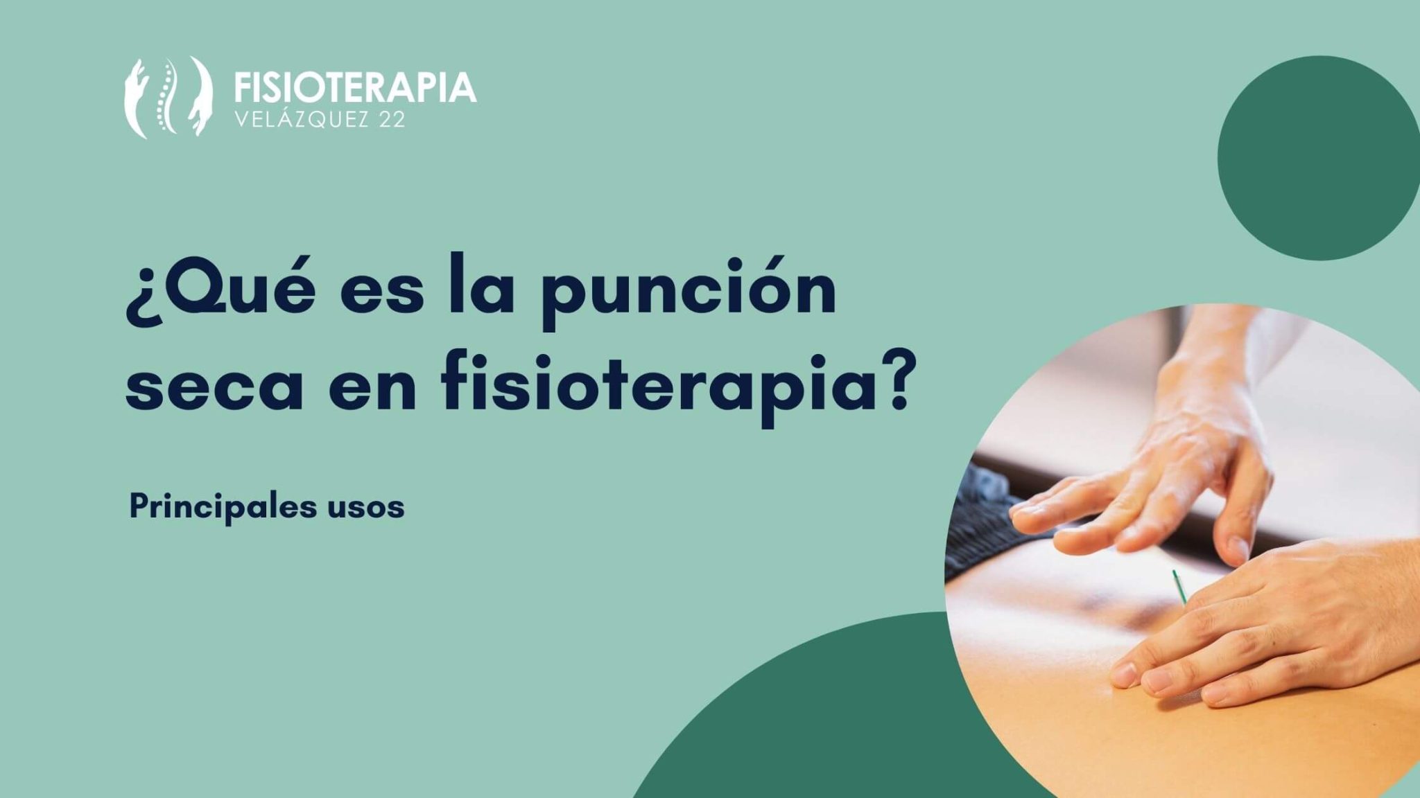 ¿Qué Es La Punción Seca? | Fisioterapia Velázquez 22