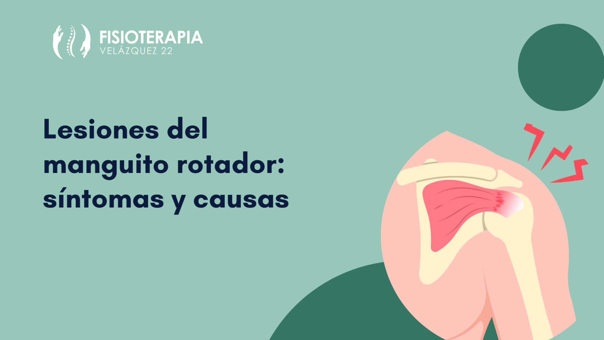 Lesiones del manguito rotador: síntomas y causas - Fisioterapia ...